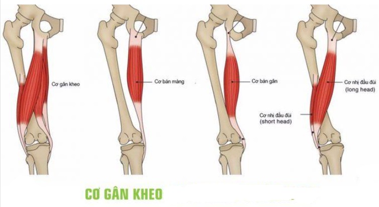 Chấn thương gân kheo là gì - VUA PHÁ LƯỚI